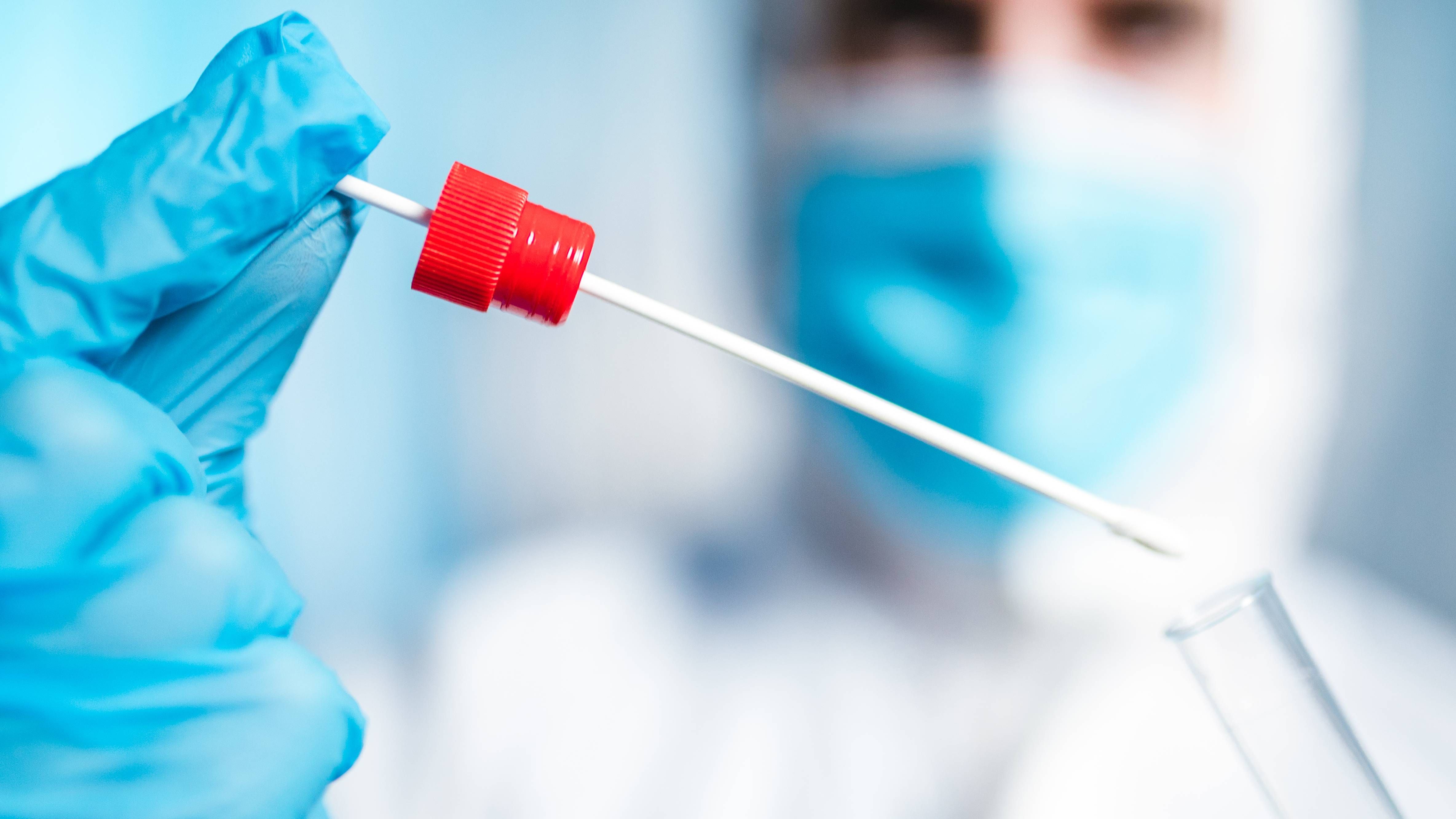 Test RT-PCR - MedTime