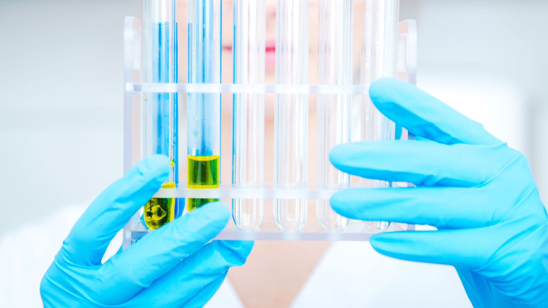 Set analize laborator screening - MedTime